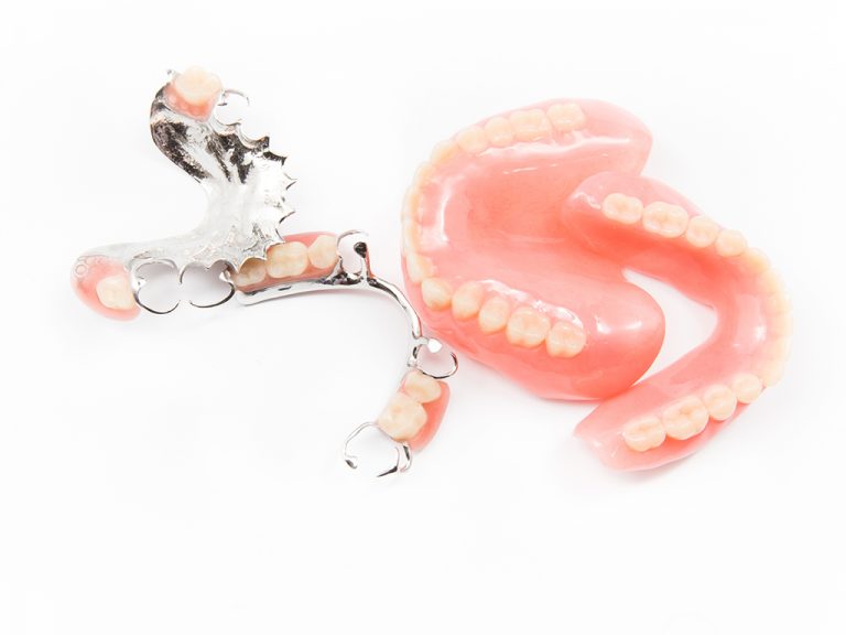 Missing Back Teeth? - Olds Denture & Implant Centre